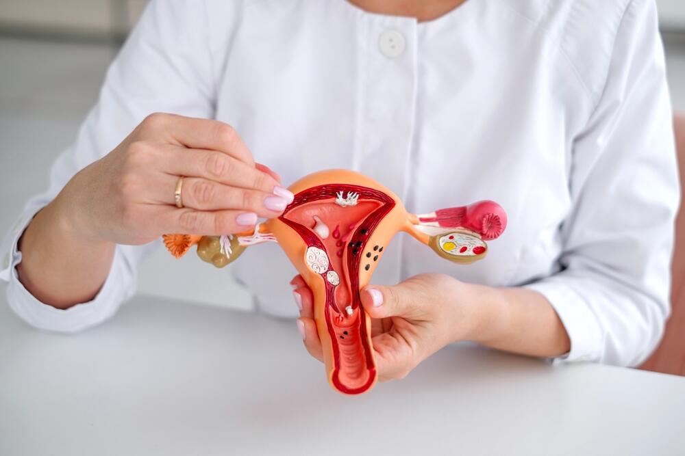 Sindrom policističnih jajnika: SImptomi, lečenje i pravilna ishrana